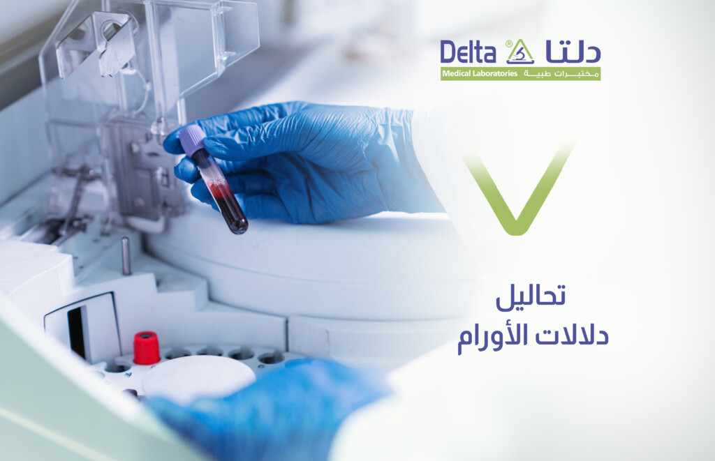 ما هي تحاليل دلالات الأورام او السرطانات ؟ مختبرات دلتا الطبية