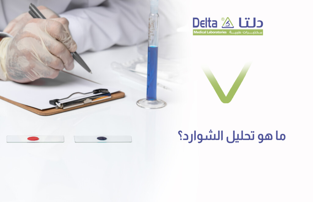ما هو تحليل الشوارد في الجسم؟ مختبرات دلتا الطبية